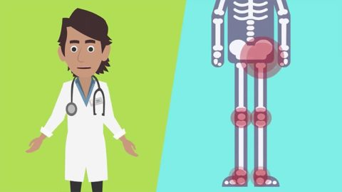 Animations - Flagstaff Foot Doctors